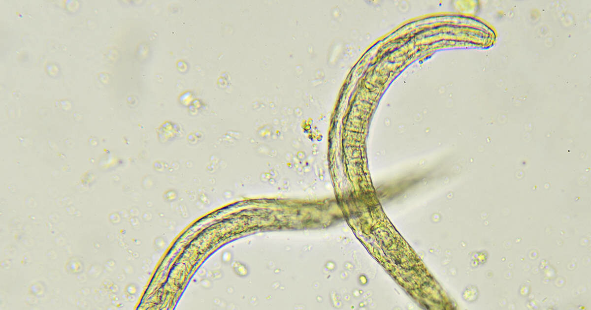 Tapeworm Eggs In Human Stool