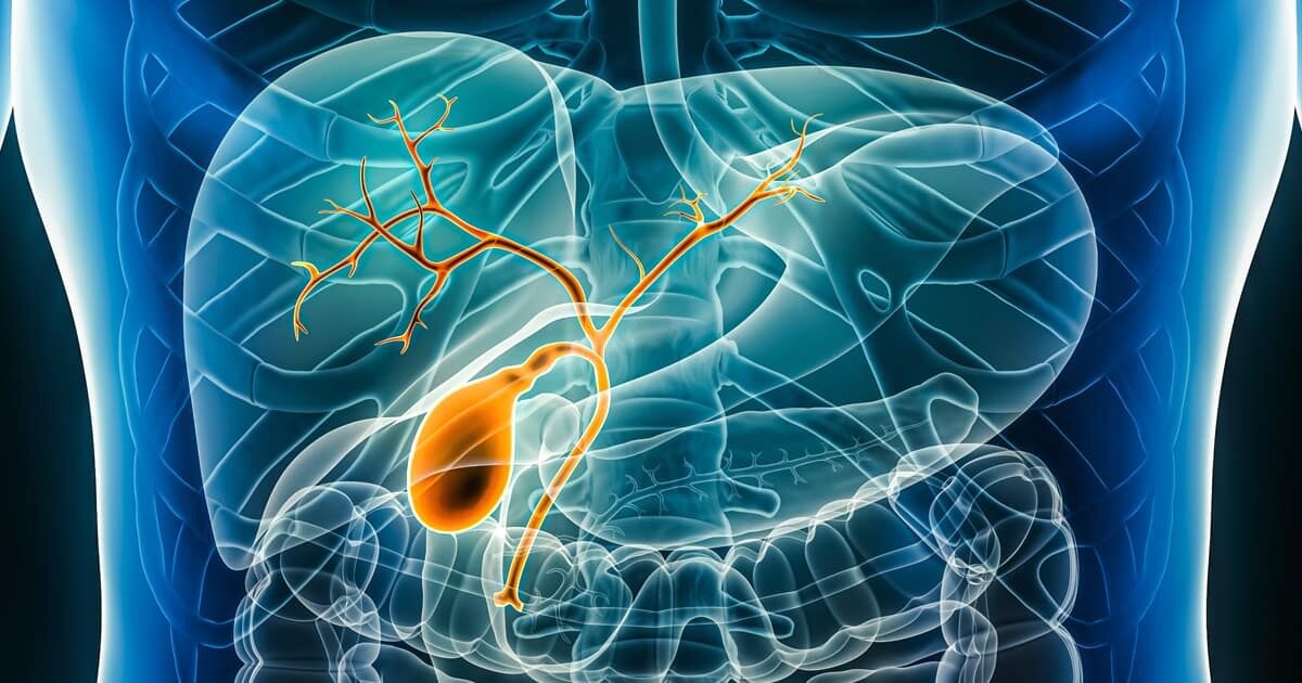Cary Gastroenterology Associates How Serious Is Bile Duct Cancer