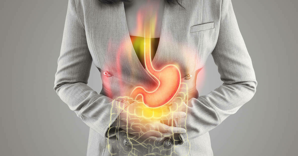 Cary Gastroenterology Associates | Laryngopharyngeal Reflux: Causes,…