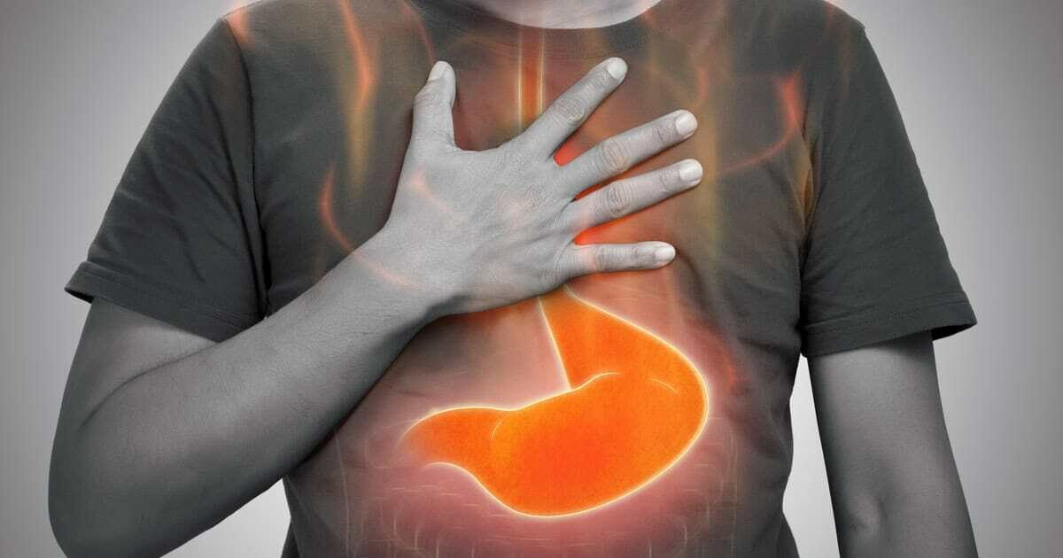 Cary Gastroenterology Associates | TIF Procedure: A Minimally…