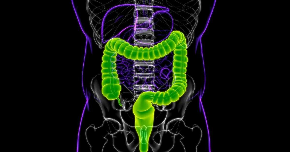 Cary Gastroenterology Associates | Recognizing Toxic Megacolon: A…